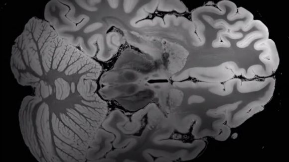 Is This the Highest Resolution MRI Scan of the Human Brain Ever? - The ...