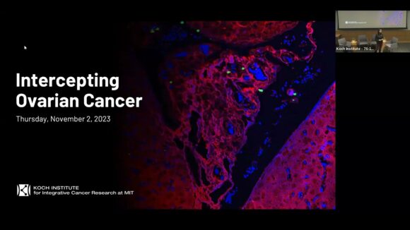 Intercepting Ovarian Cancer - The Doctor's Channel - Short Videos for ...