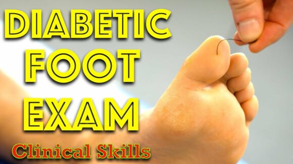 Diabetic Foot Examination – Clinical Skills – Dr. Gill - The Doctor's ...